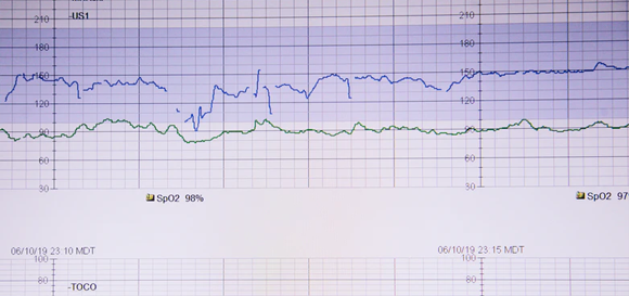 IntelliH @ Clinic- Telecardiology – Intellihinc